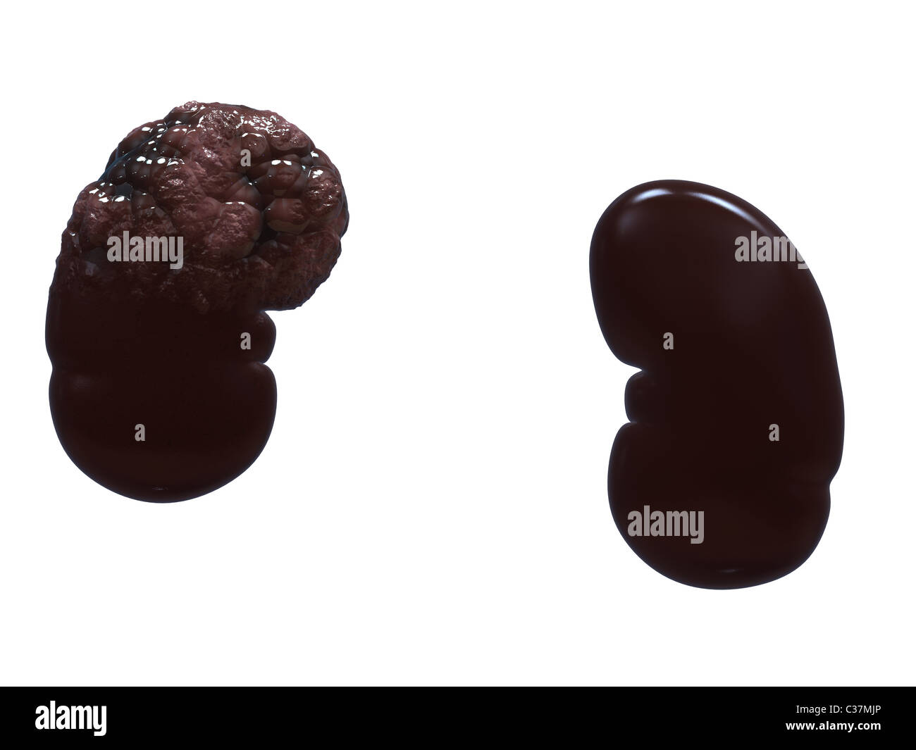 Human kidney hi-res stock photography and images - Alamy