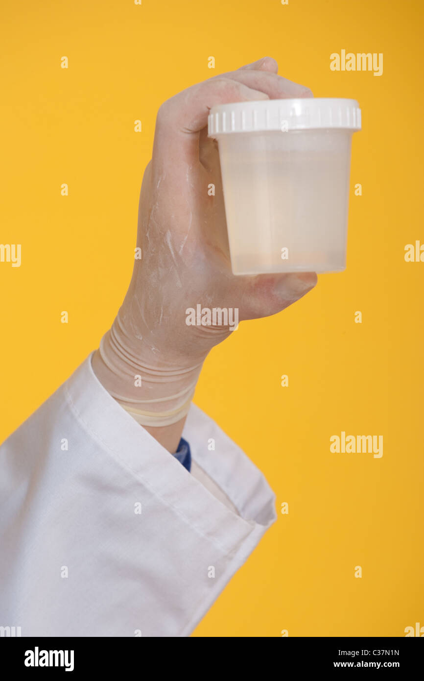 Specimen container hi-res stock photography and images - Alamy