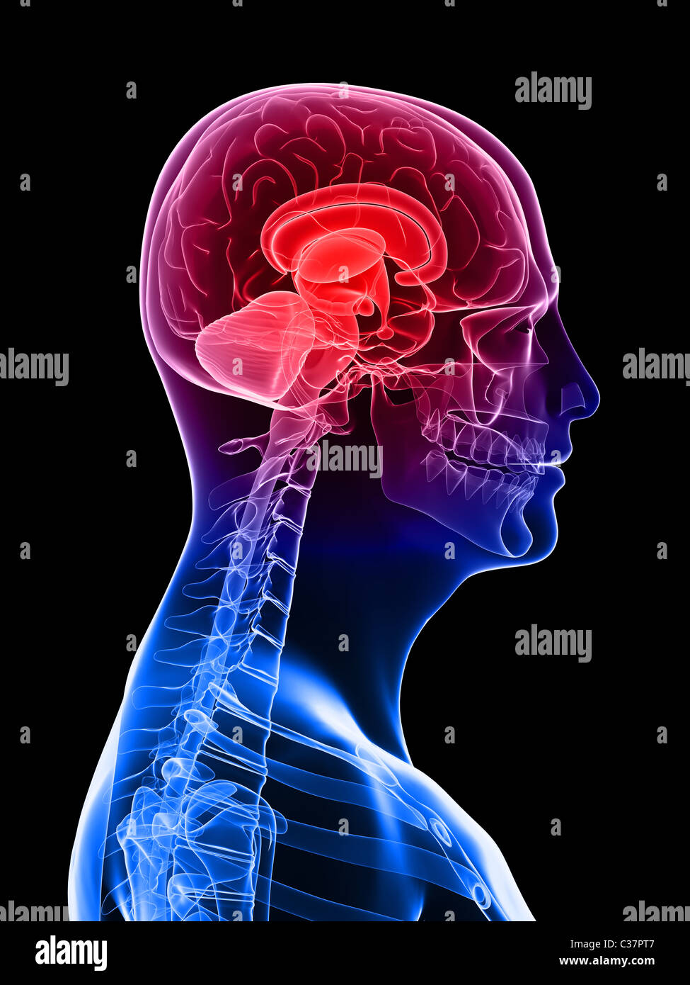 headache / migraine Stock Photo - Alamy