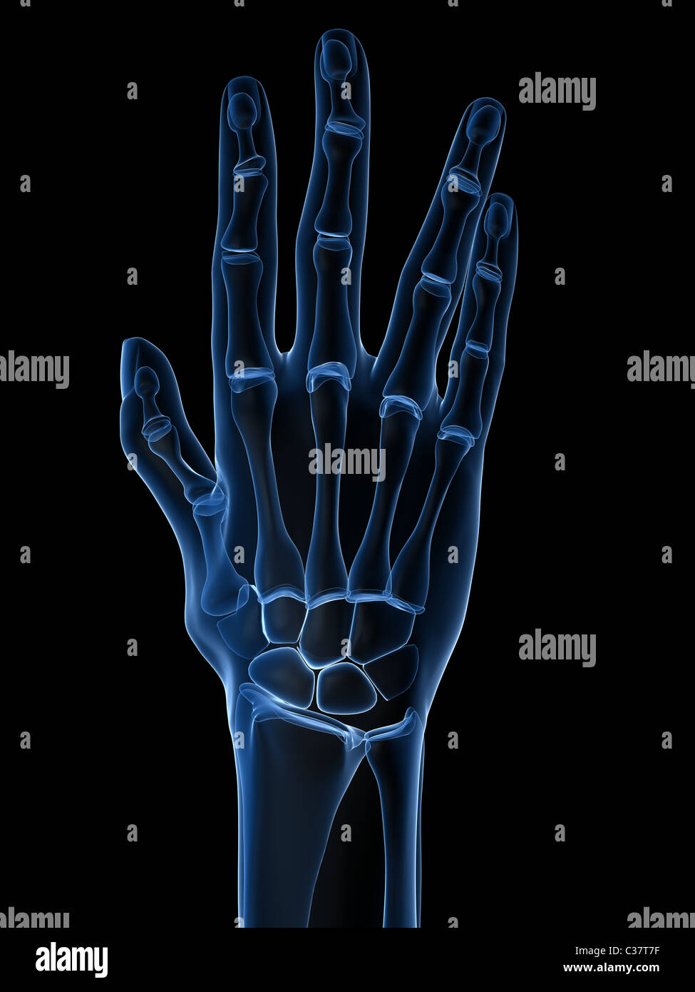 X Ray Hands Arthritis High Resolution Stock Photography and Images - Alamy