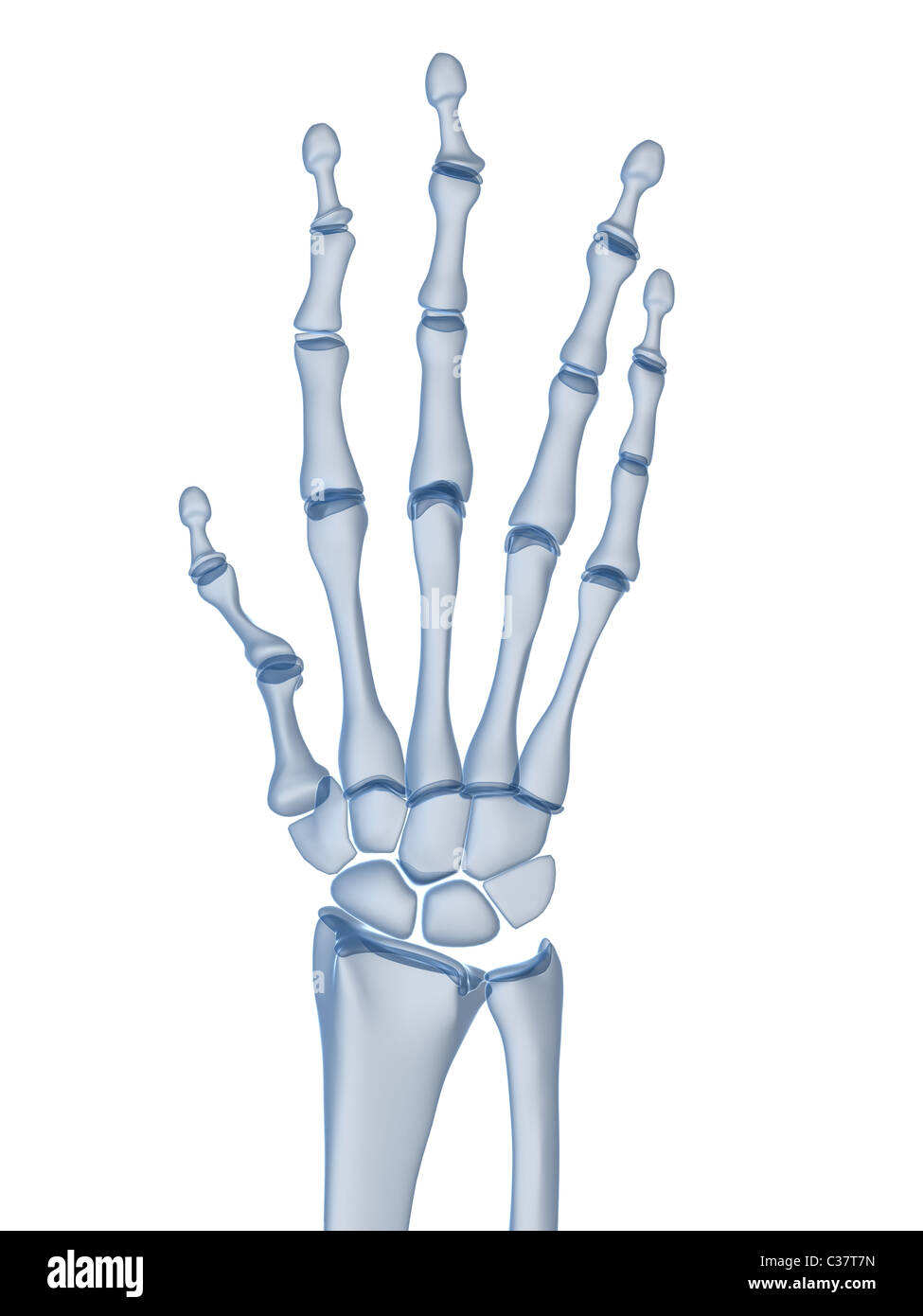 X ray hands arthritis hi-res stock photography and images - Alamy