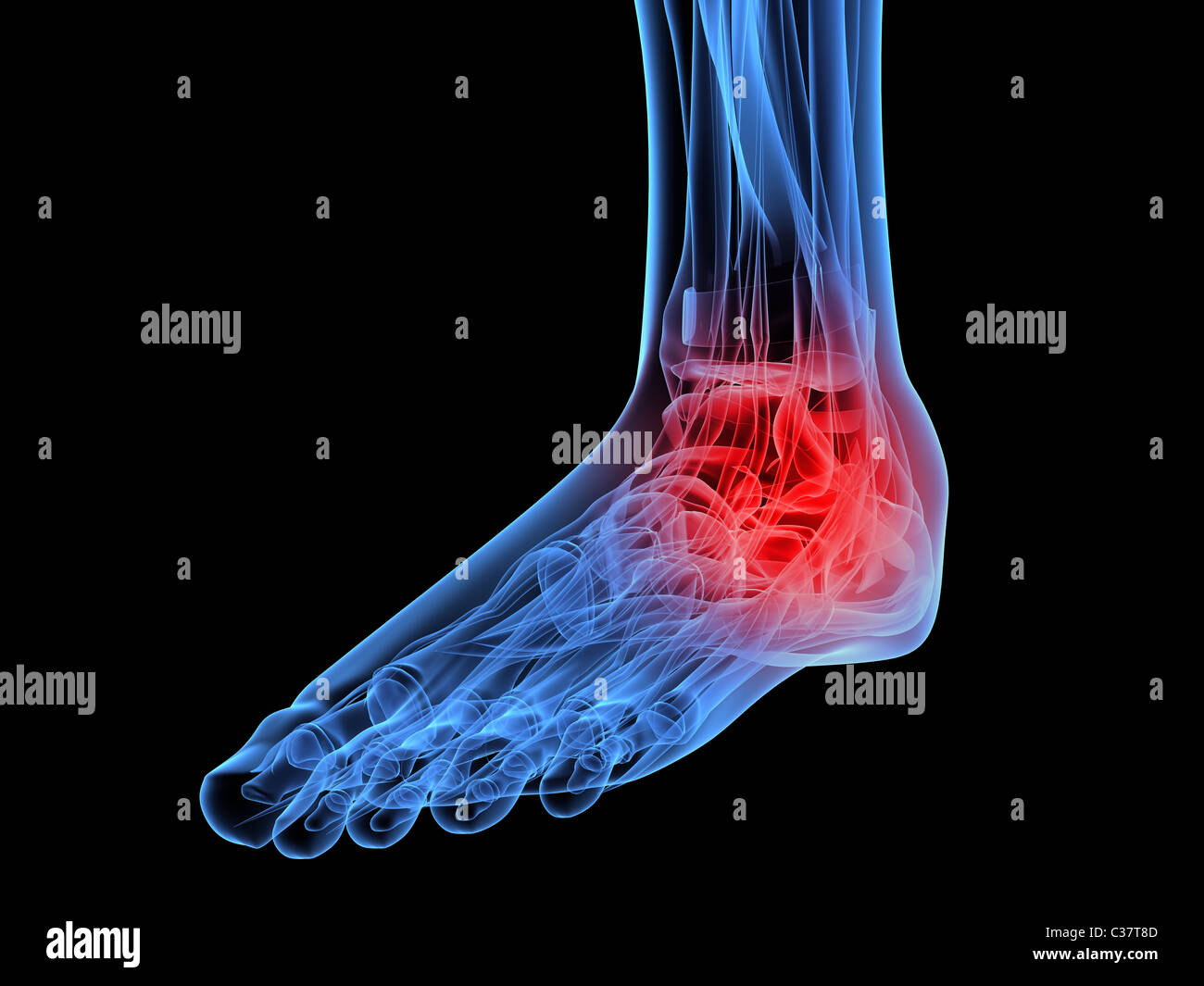 Ankle x ray hi-res stock photography and images - Alamy