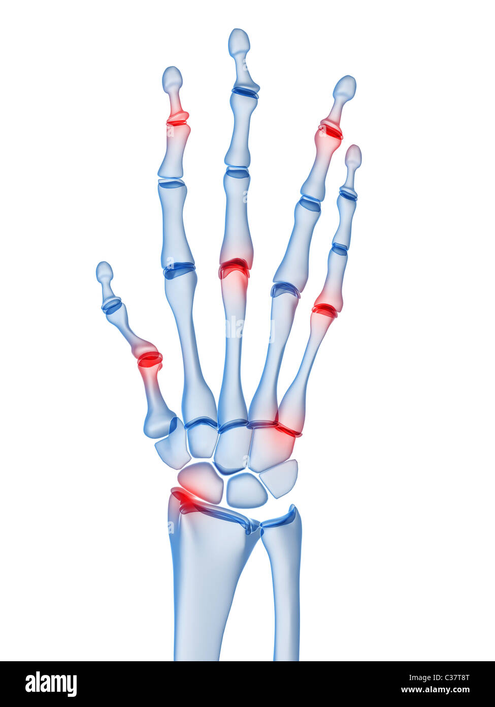 human hand - arthritis Stock Photo - Alamy