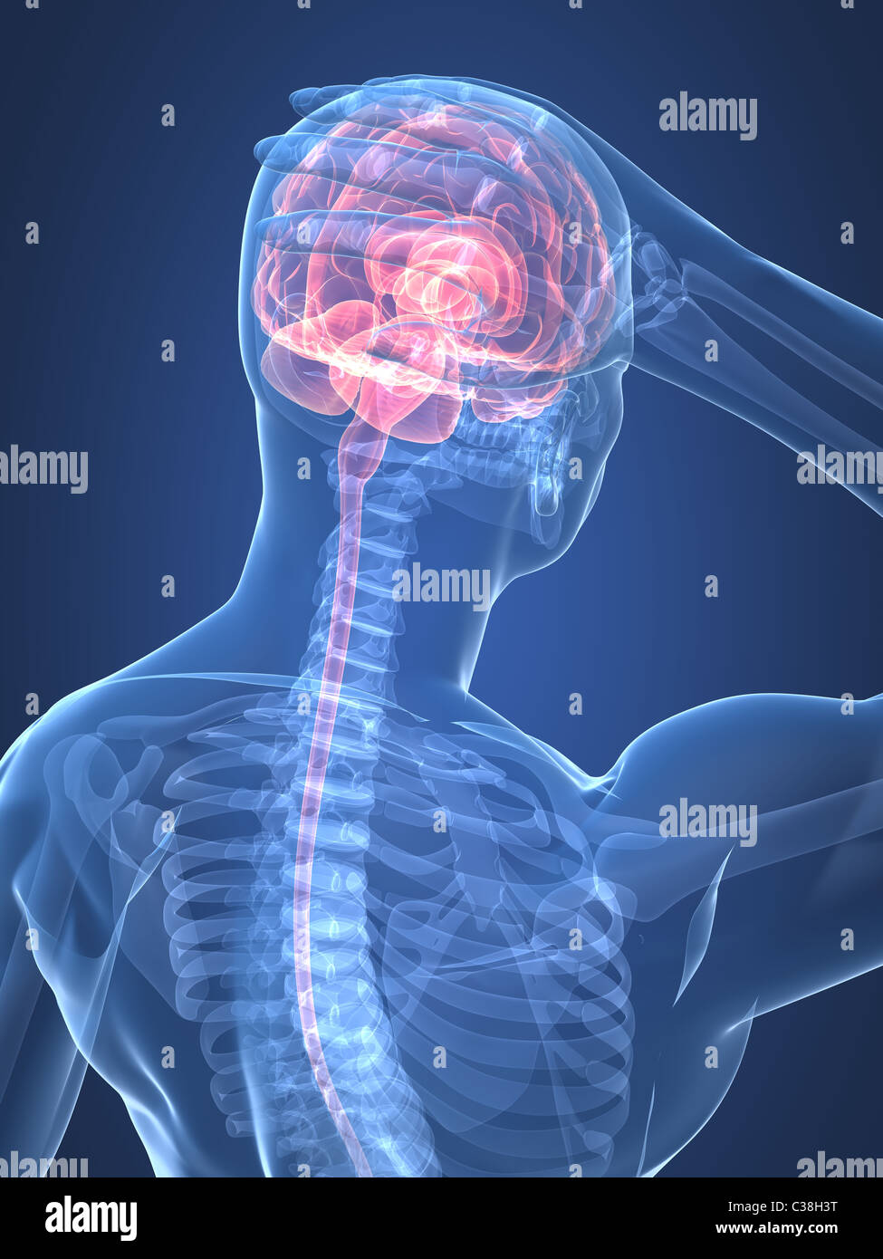 headache / migraine Stock Photo - Alamy