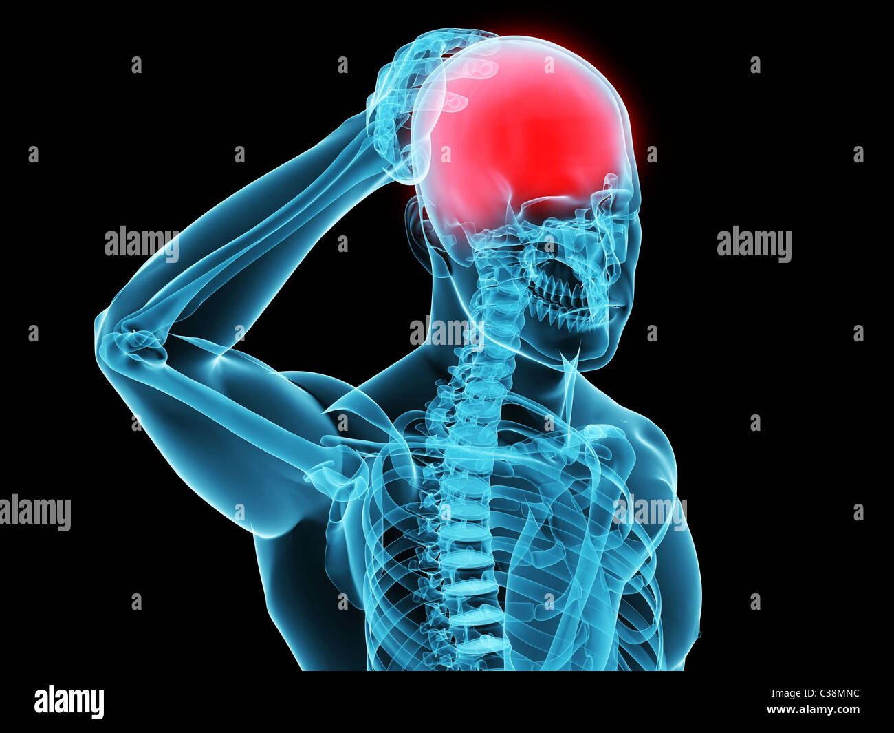 headache / migraine Stock Photo - Alamy