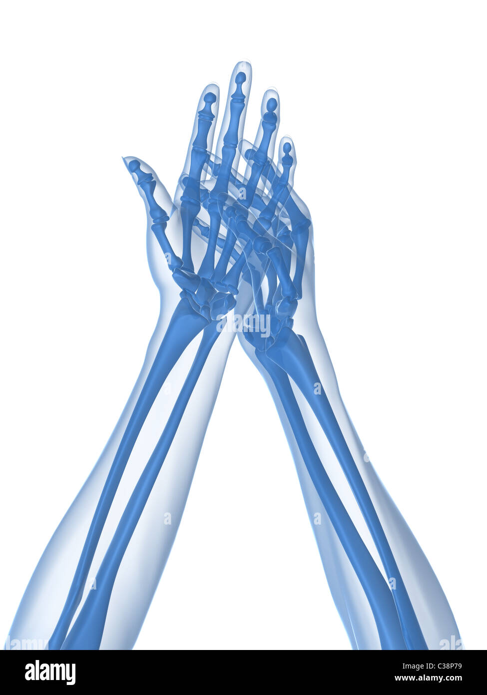 x-ray hands - arthritis Stock Photo - Alamy