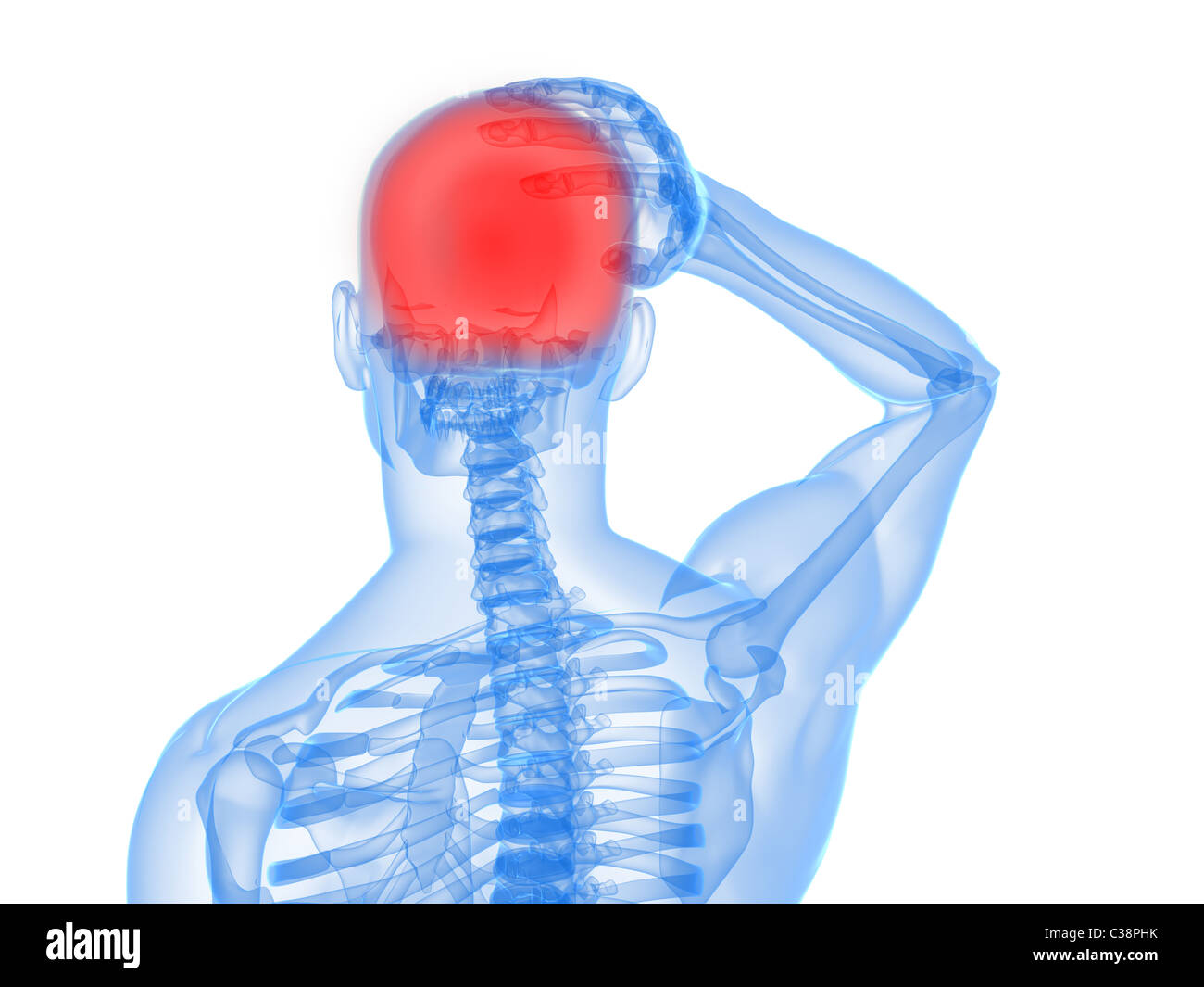 Migraine brain hi-res stock photography and images - Alamy