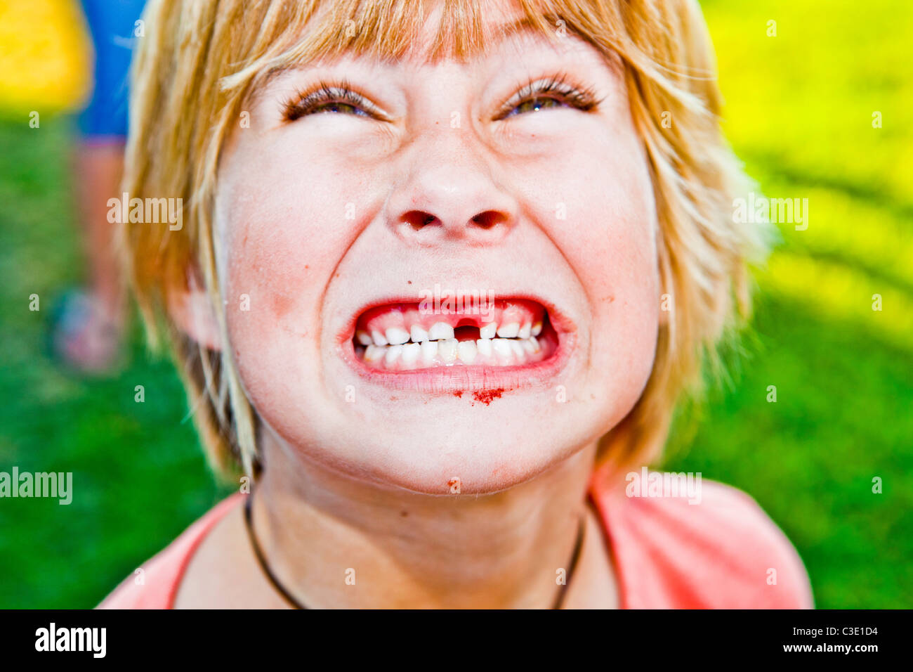 boy showing off missing tooth Stock Photo - Alamy