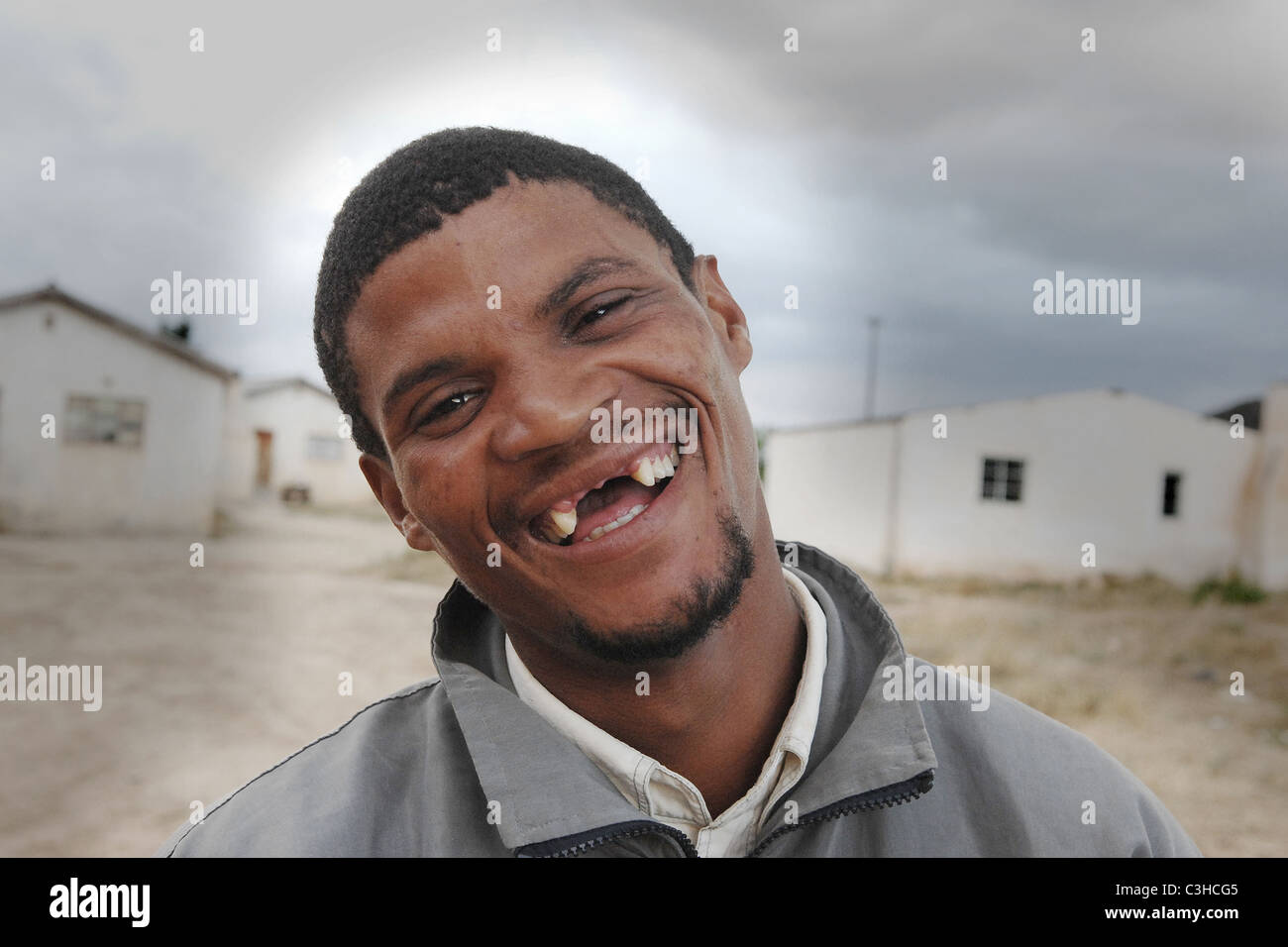 Black Man Smiling With No Teeth