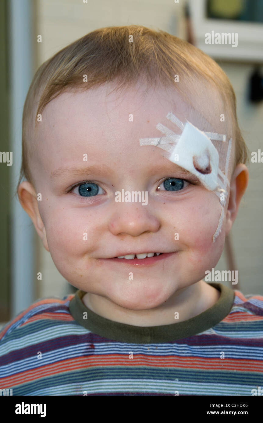 Toddler with bandage over cut above his eyebrow Stock Photo - Alamy
