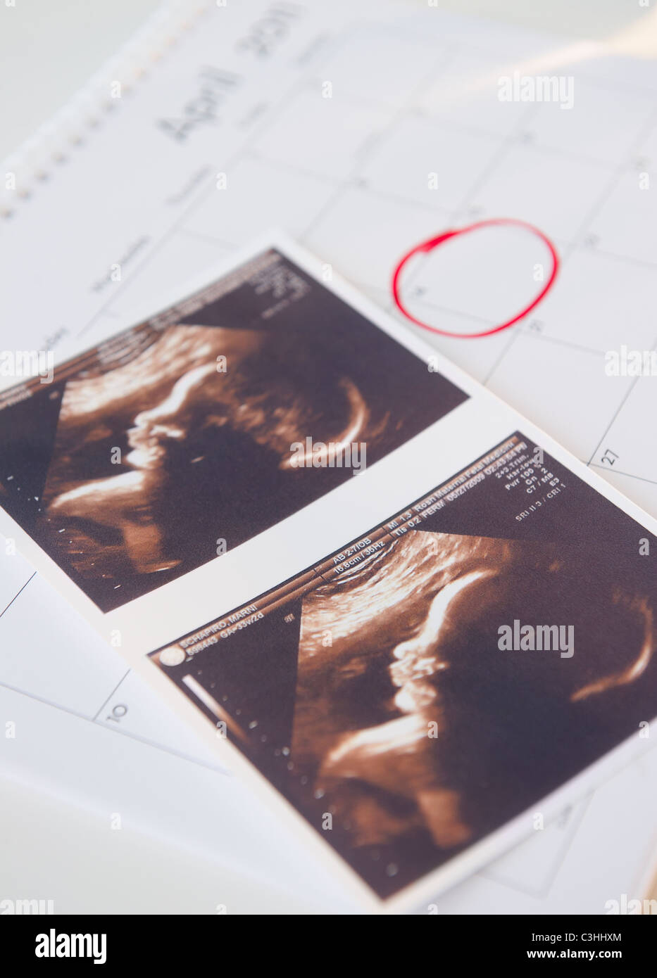 Ultrasound hi-res stock photography and images - Alamy