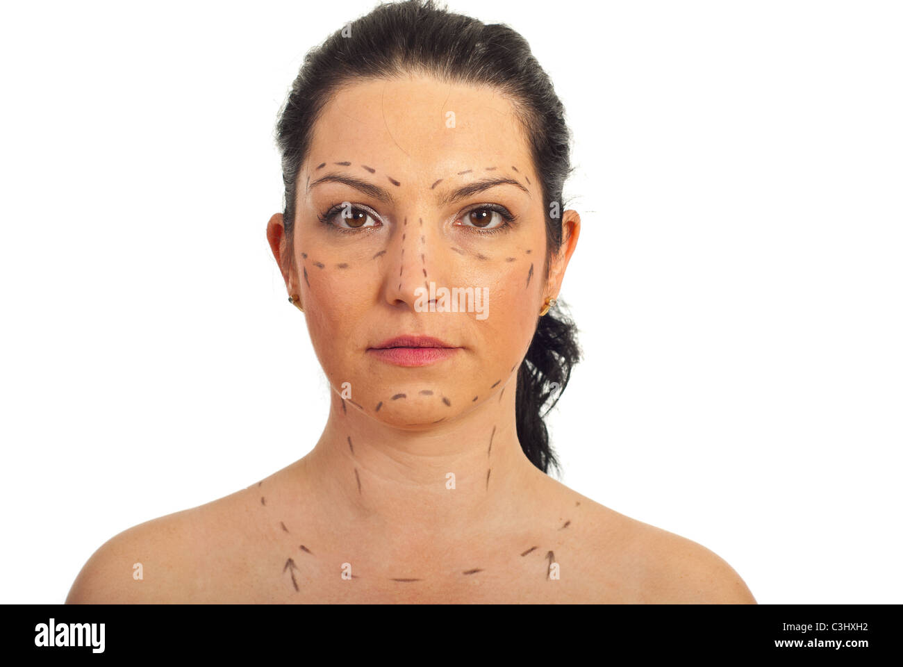 Portrait of mid adult woman face prepared for plastic surgery isolated ...