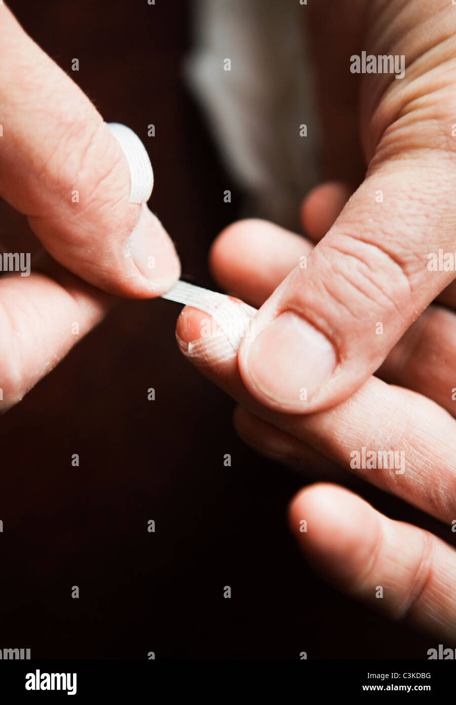 Close-up view of mans hand dressing flash wound of finger Stock Photo ...