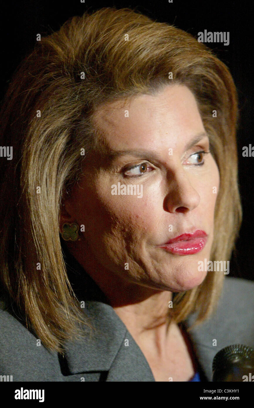 Nancy brinker hi-res stock photography and images - Alamy