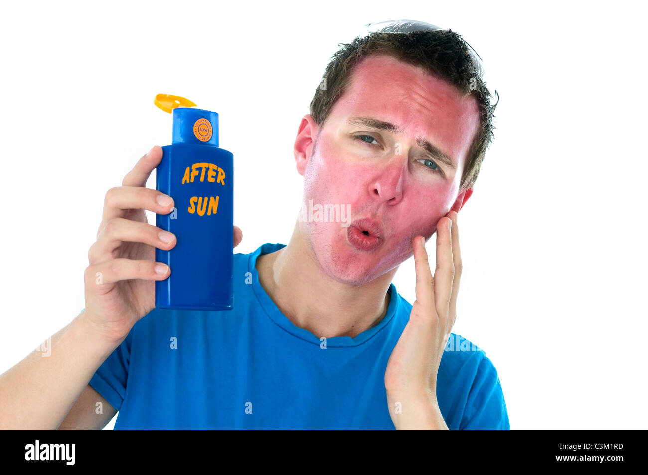 Young man with sunburnt face Stock Photo: 36705185 - Alamy