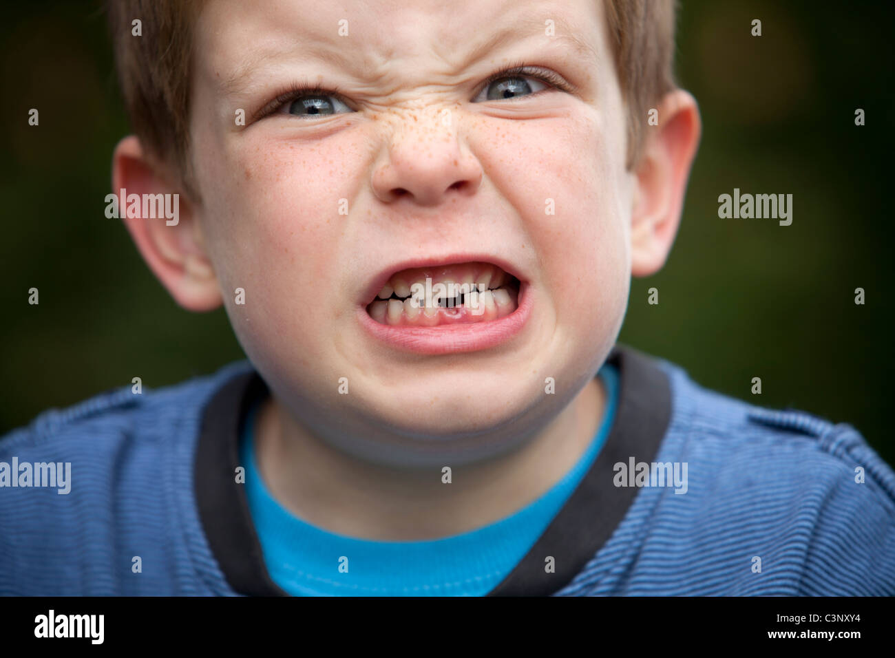A young boy shows off his missing front tooth Stock Photo - Alamy