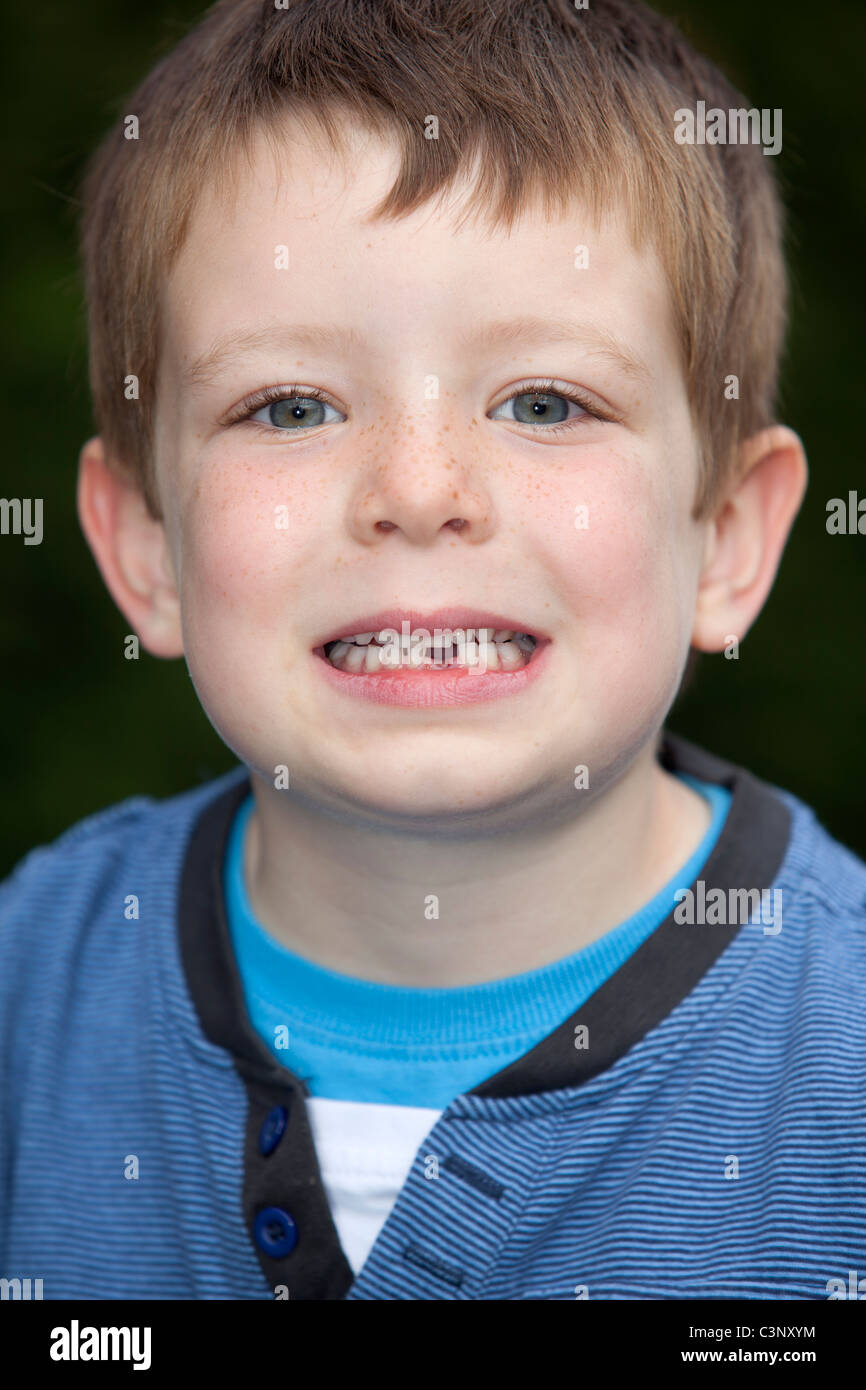 A young boy shows off his missing front tooth Stock Photo - Alamy