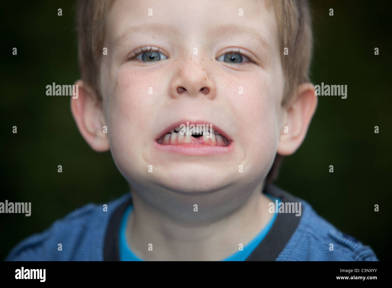 Loose front tooth hi-res stock photography and images - Alamy