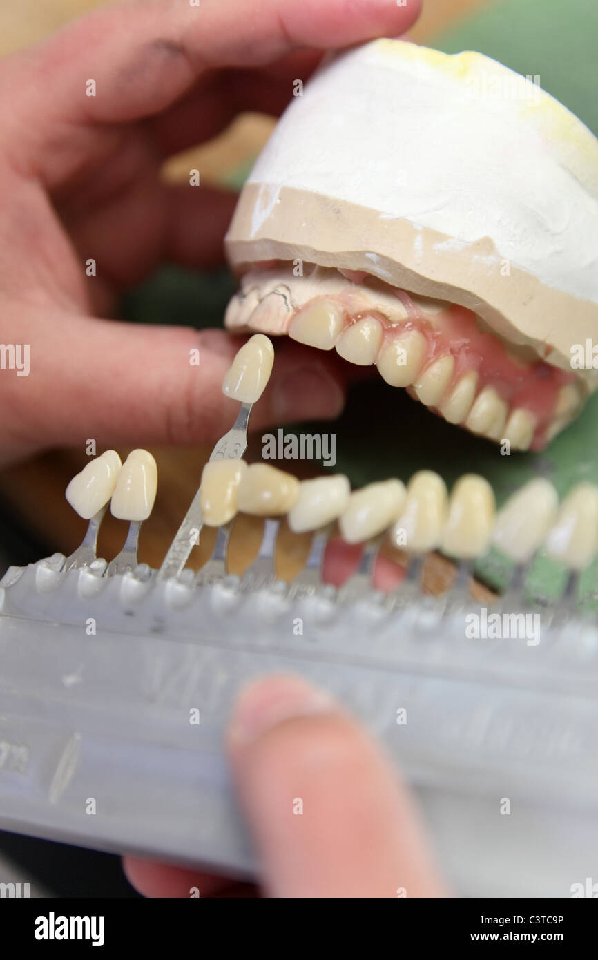 Work in a dental laboratory Stock Photo - Alamy