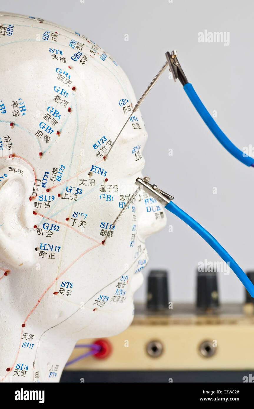 Electric acupuncture hi-res stock photography and images - Alamy