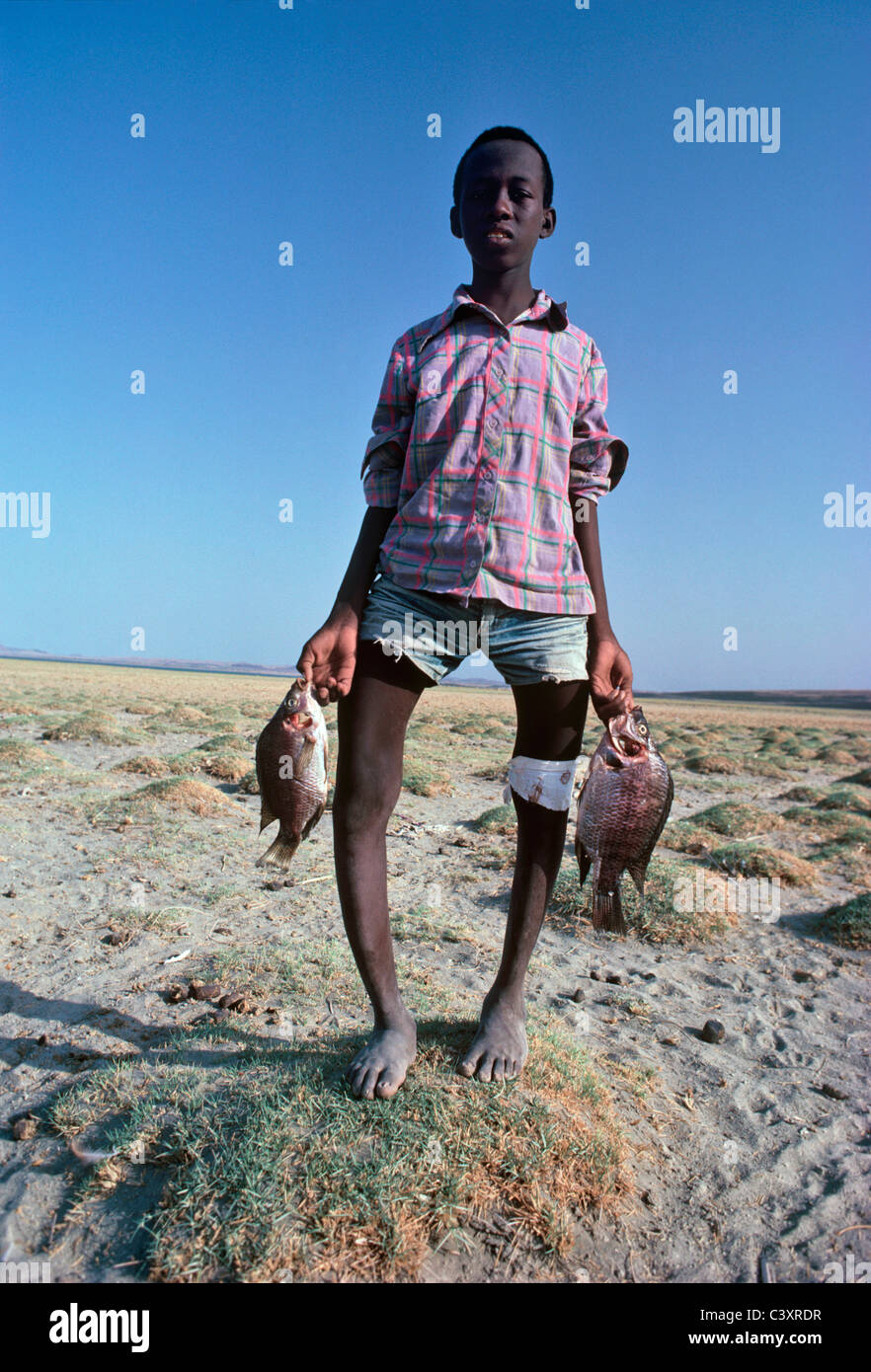 Rickets child hi-res stock photography and images - Alamy
