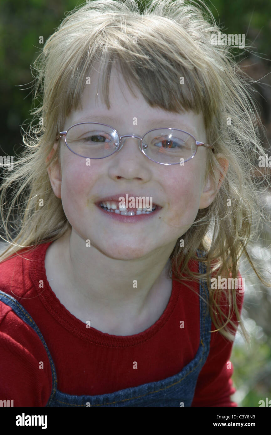 Child missing eye hi-res stock photography and images - Alamy