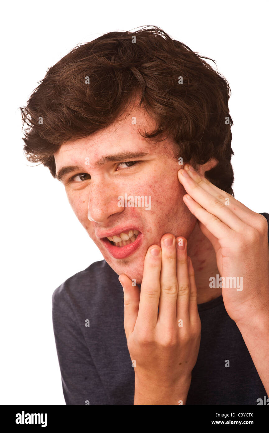Bad skin hi-res stock photography and images - Alamy