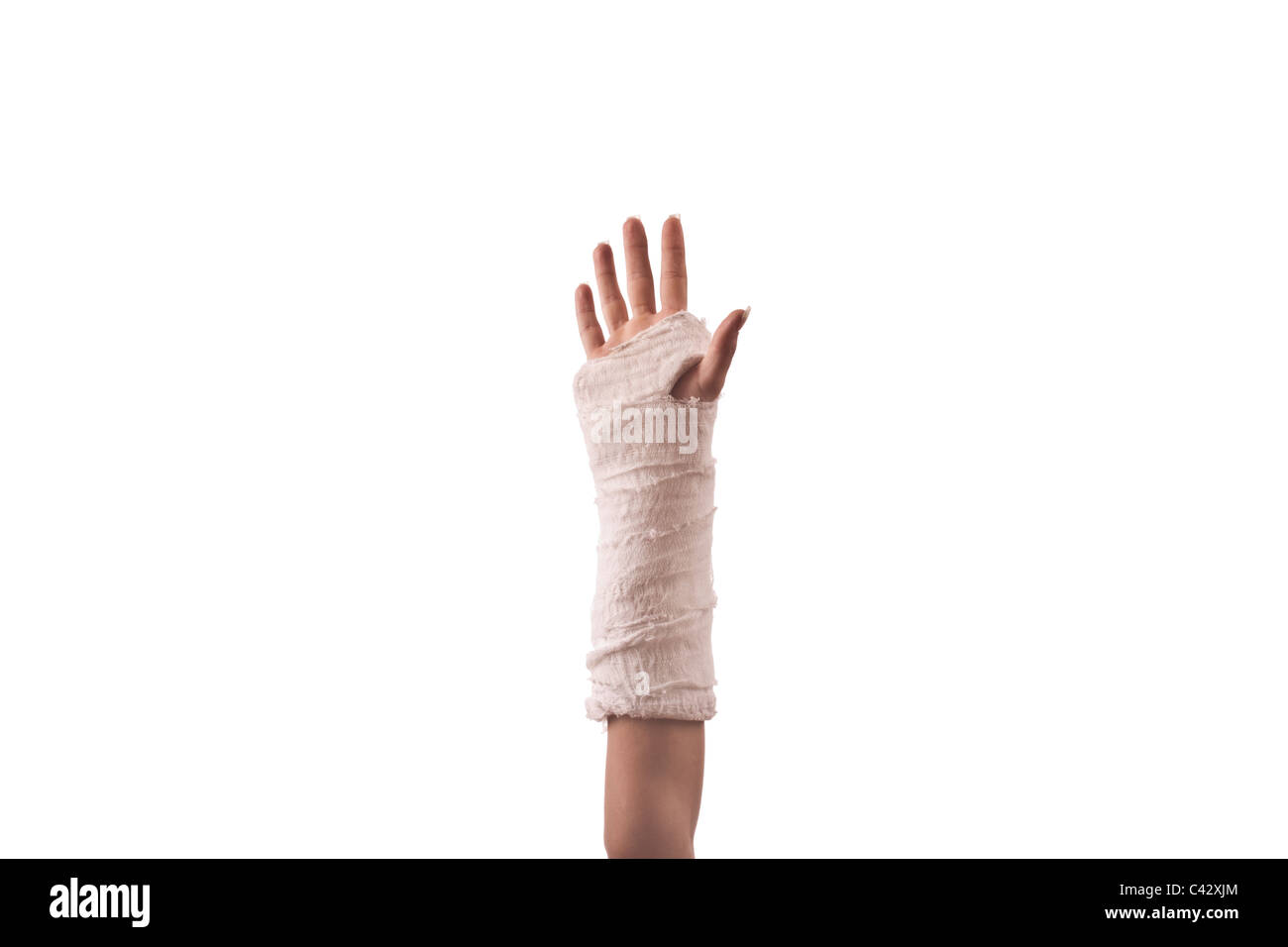broken hand in cast on white background Stock Photo - Alamy