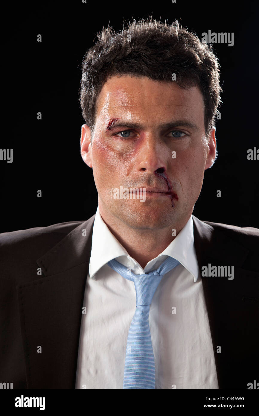 A tough businessman with bruises Stock Photo - Alamy