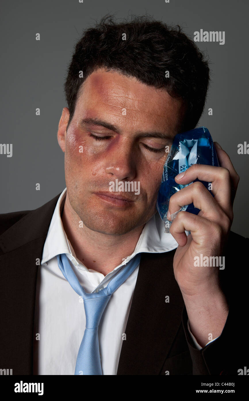 A beaten up businessman holding an ice pack on his cheek Stock Photo ...