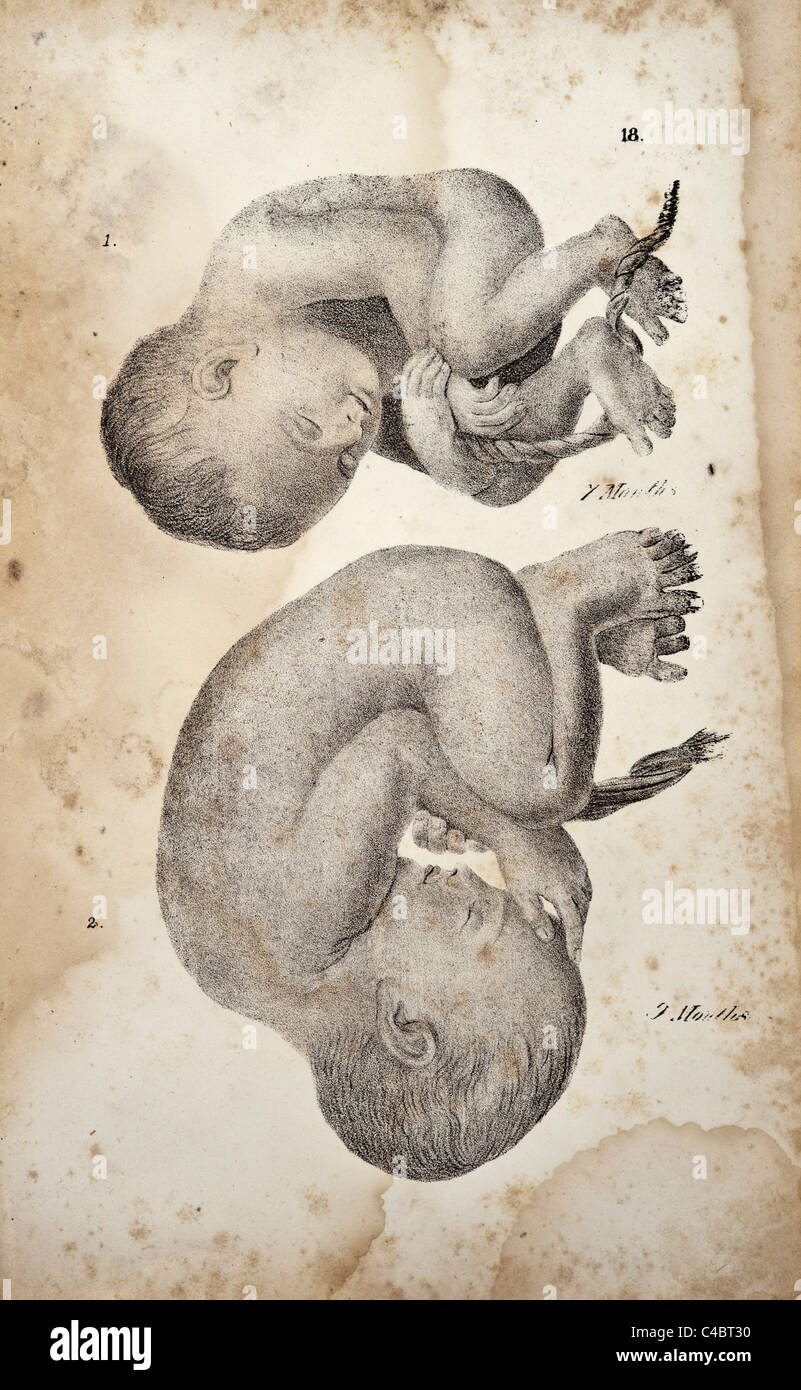 Inferior vena cava hi-res stock photography and images - Alamy