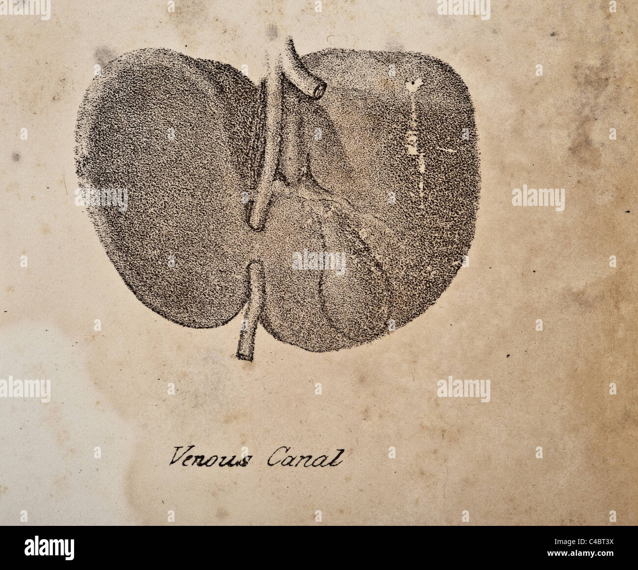 Venous vein fetal canal blood birth hi-res stock photography and images ...