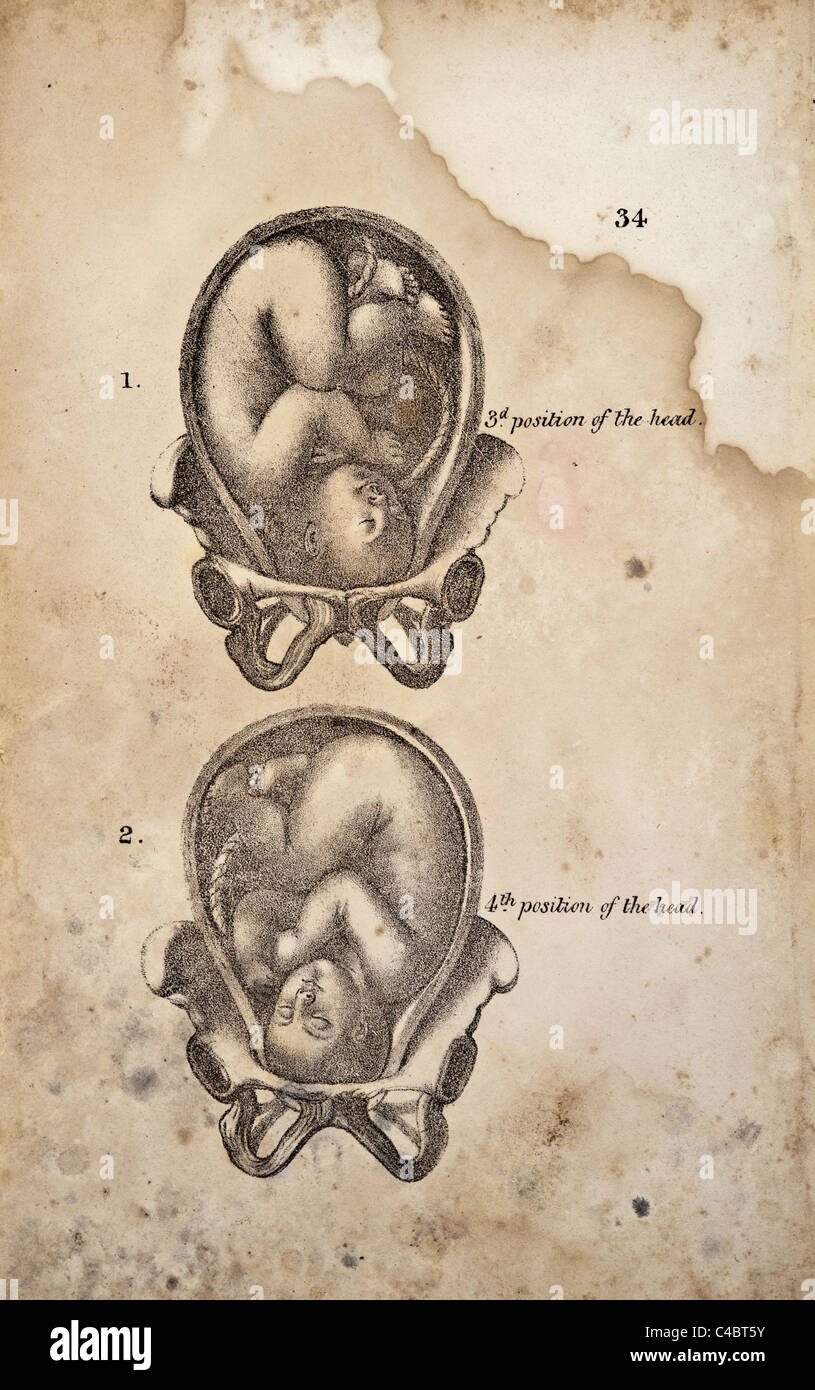 Illustration of Human Child before Birth copyright 1844 Stock Photo - Alamy