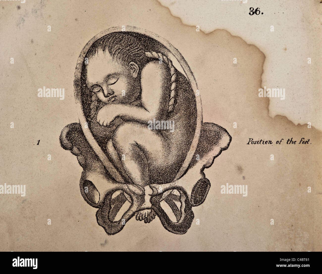 Illustration of Human Child before Birth copyright 1844 Stock Photo - Alamy
