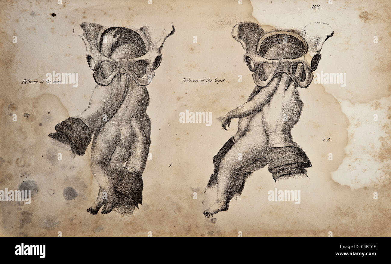 Birth canal illustration hi-res stock photography and images - Alamy