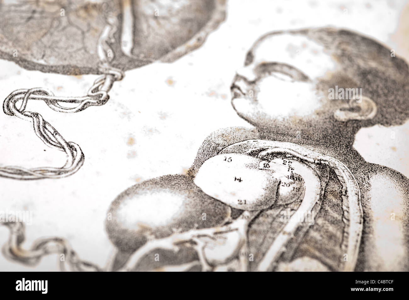 Illustration of Human Child before Birth copyright 1844 Stock Photo - Alamy