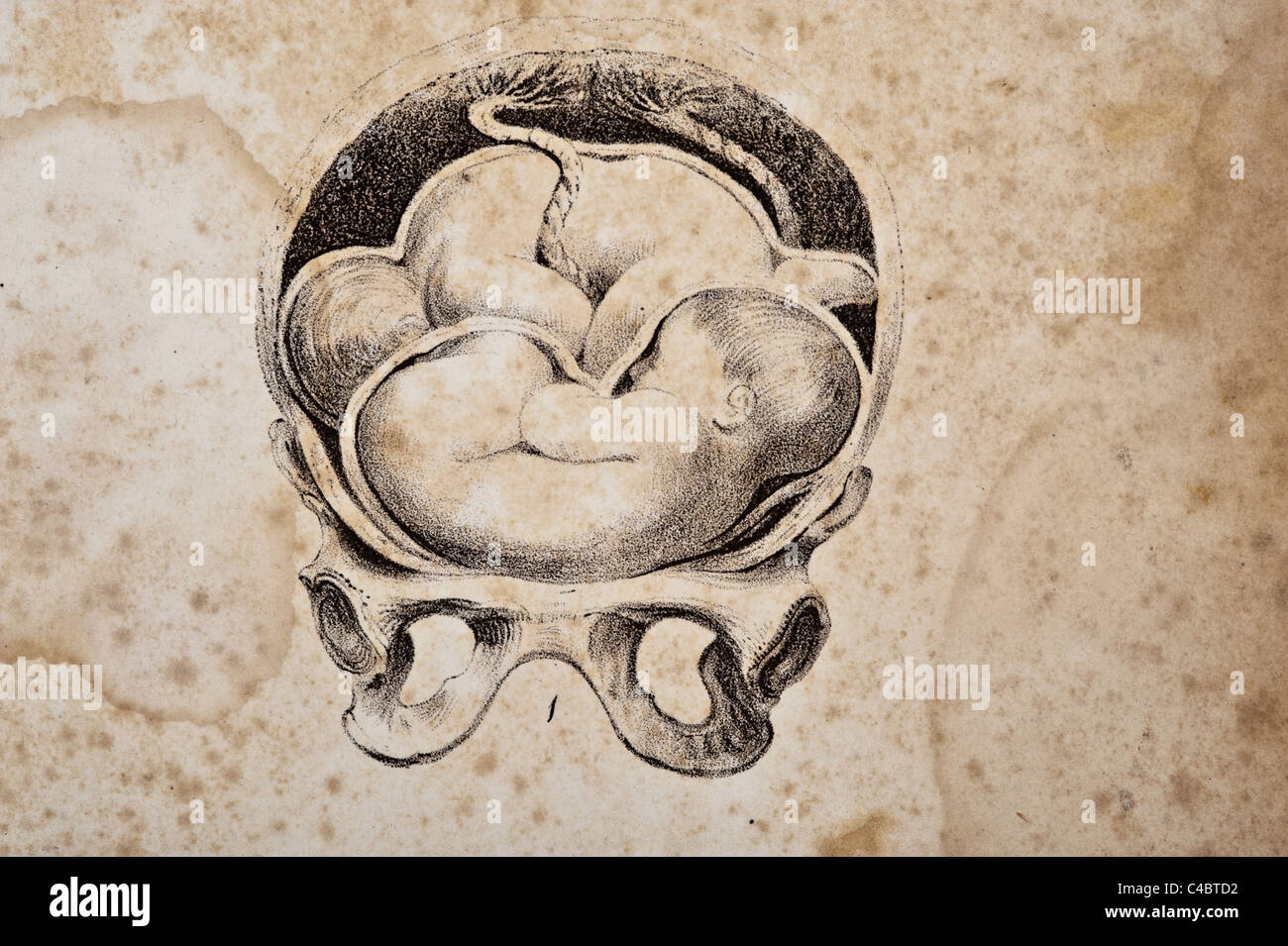 Twins Talking In The Womb at Isla Lascelles blog