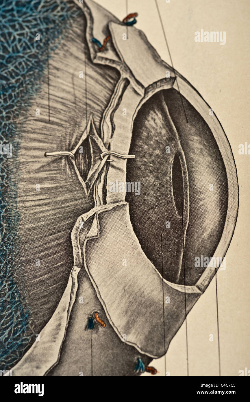 Photoreceptor cells human eye hi-res stock photography and images - Alamy