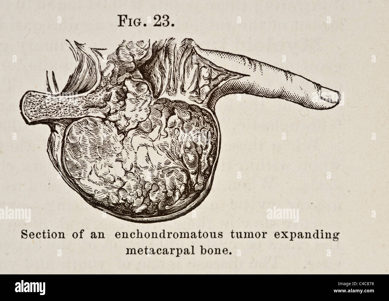 Metacarpal hi-res stock photography and images - Alamy