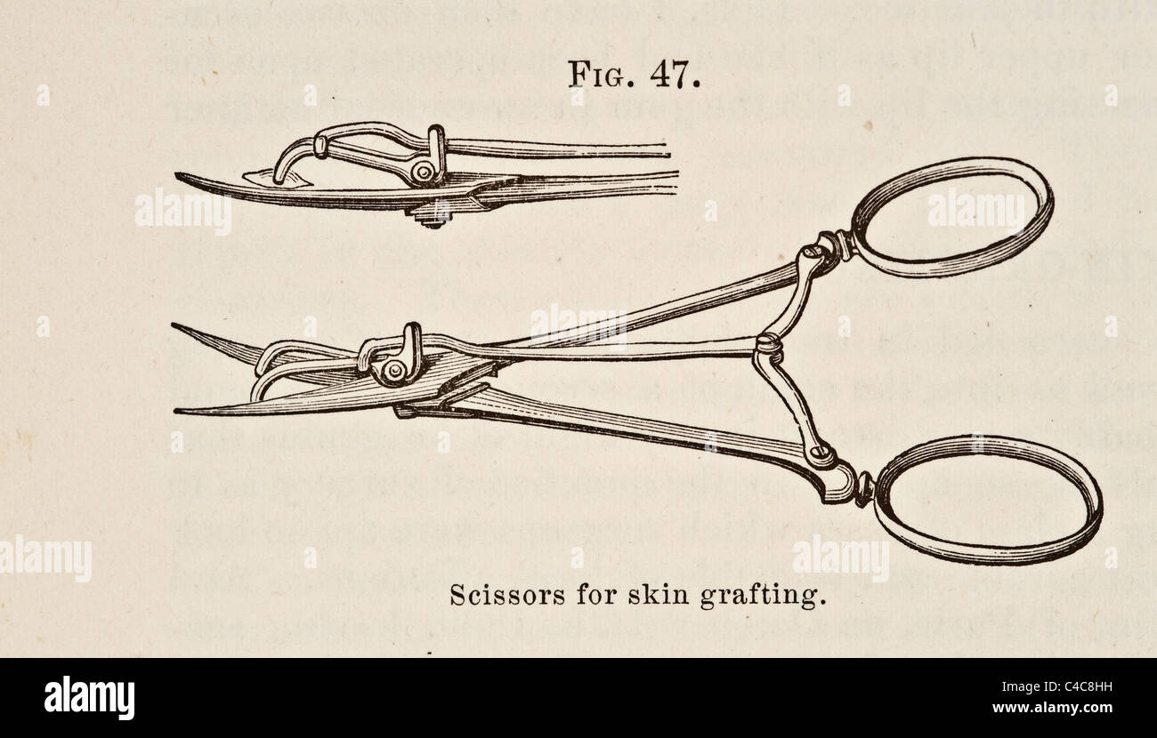 Antique Illustration of Surgical Tools and Medical Apparatus Stock ...