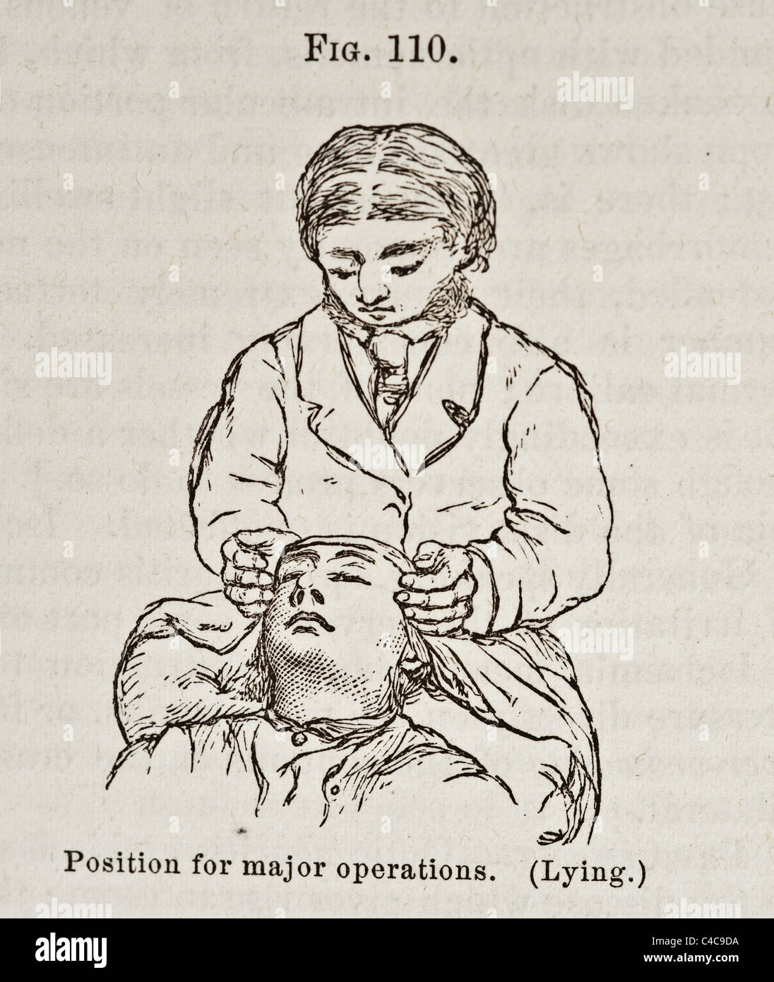 Antique Medical Illustration of Position for Major Operations circa ...