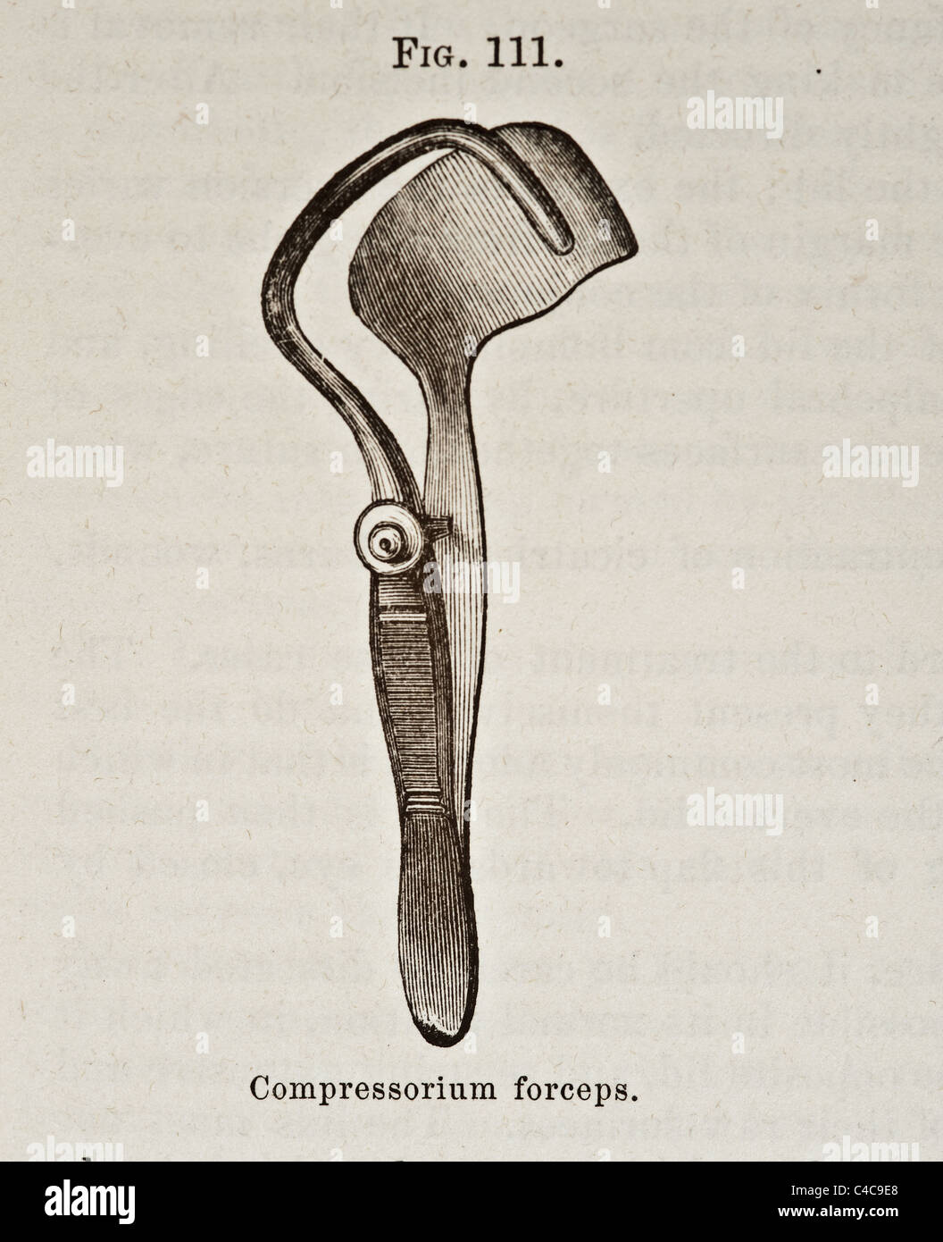 Antique Illustration of Surgical Tools and Medical Apparatus Stock ...