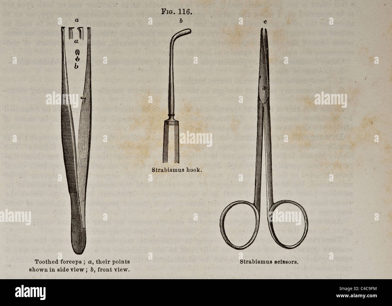 Antique Illustration of Surgical Tools and Medical Apparatus Stock ...