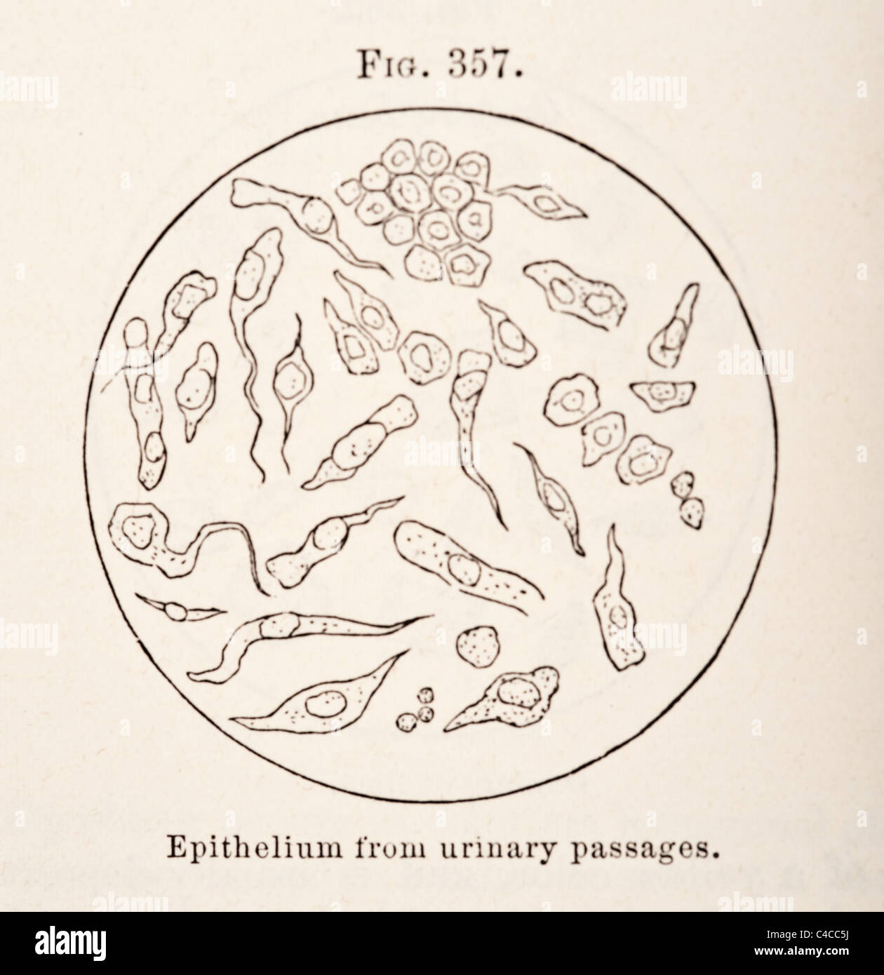 Antique Medical Illustration of Urinary Deposits circa 1881 Stock Photo ...