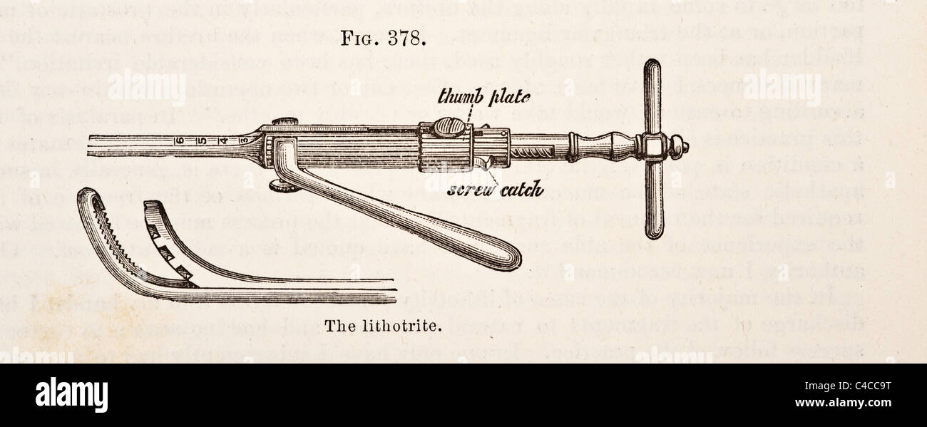 Antique Illustration of Surgical Tools and Medical Apparatus Stock ...
