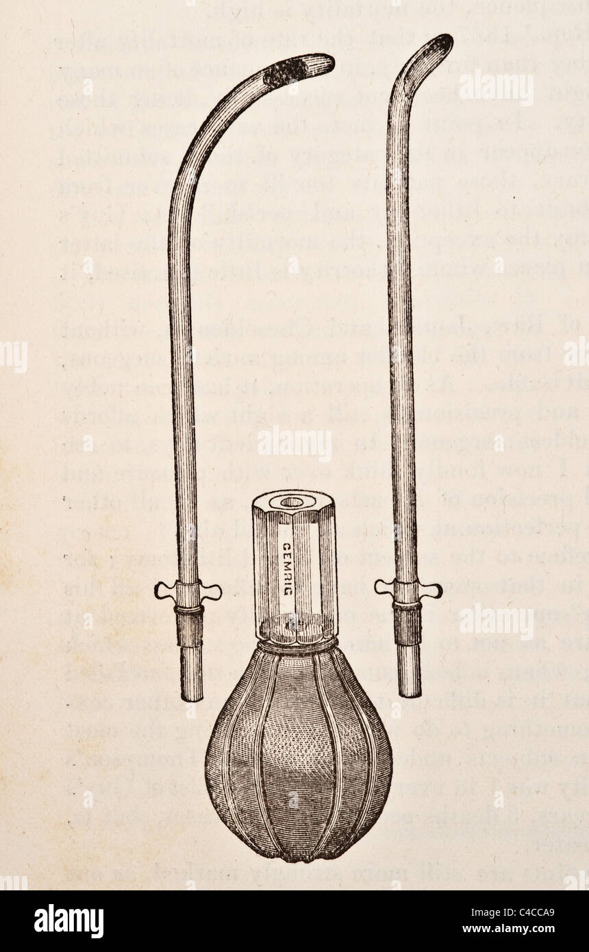 Antique Illustration of Surgical Tools and Medical Apparatus Stock ...