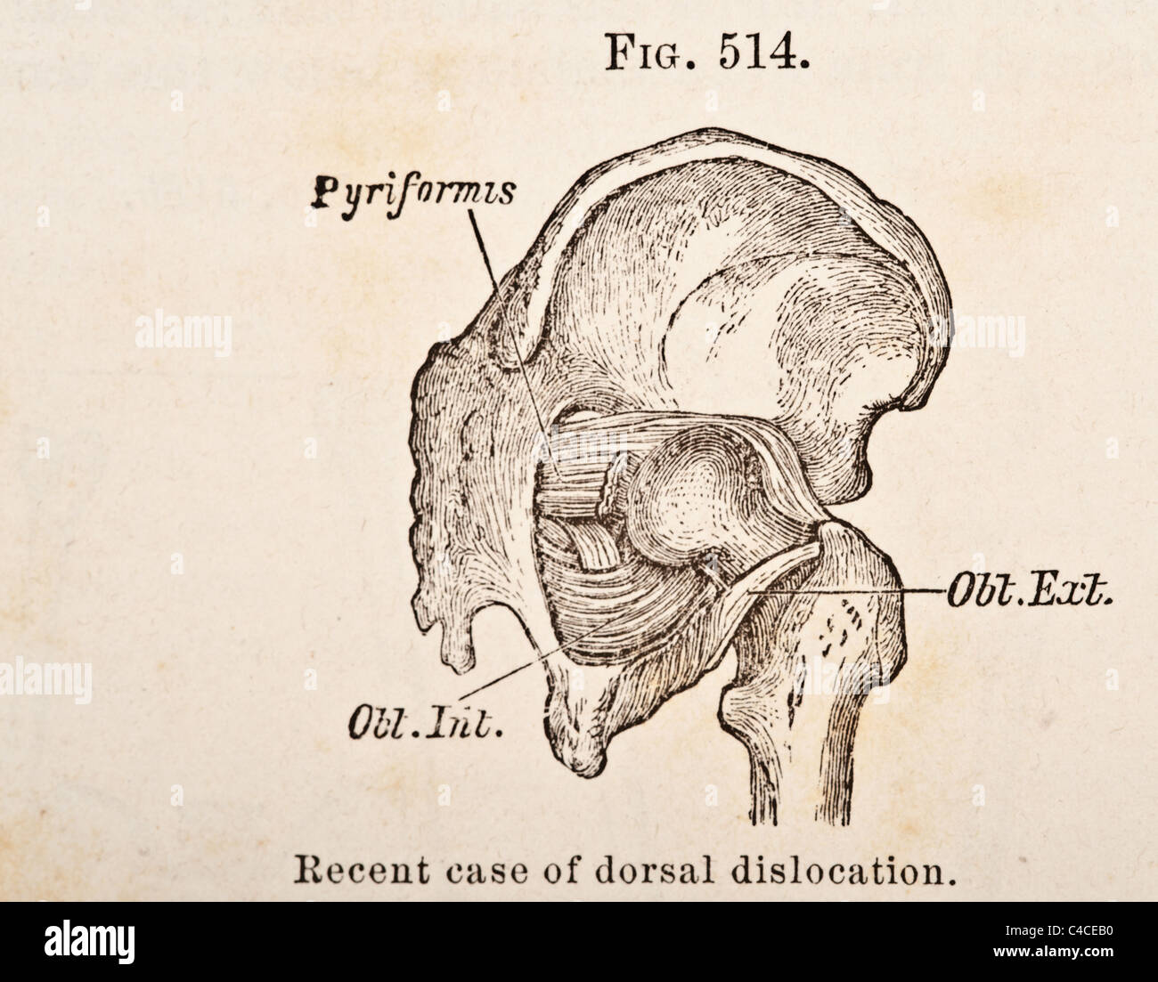 Antique medical illustration of a hip bone, ball & socket Stock Photo ...