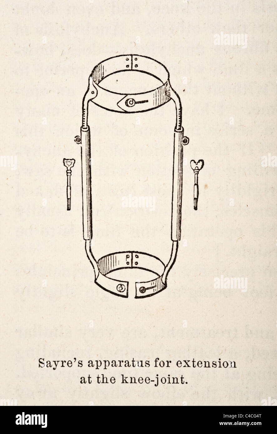 Antique Illustration of Surgical Tools and Medical Apparatus Stock ...
