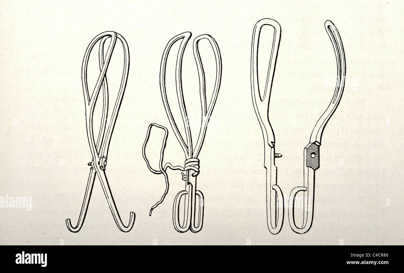 Antique Illustration of Surgical Tools and Medical Apparatus Stock ...