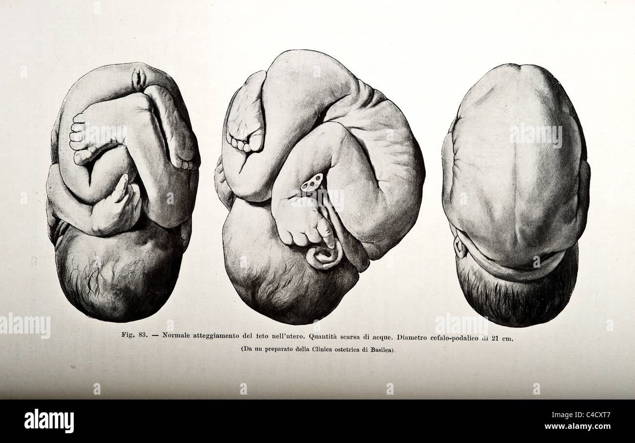 Illustration of Human Fetus copyright 1905 Stock Photo - Alamy